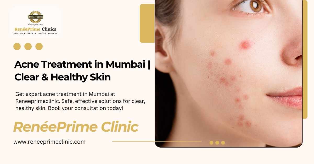 Advanced Acne Treatment in Mumbai | Clear & Healthy Skin