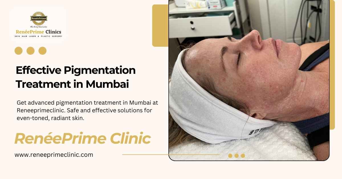 Effective Pigmentation Treatment in Mumbai | Reneeprimeclinic